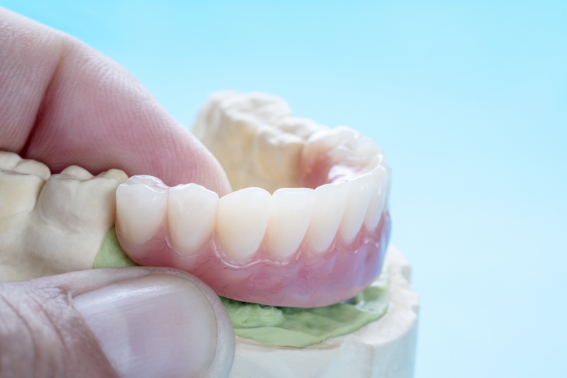 Prosthodontics Tunbridge Wells | Woodbury Park Dental Surgery